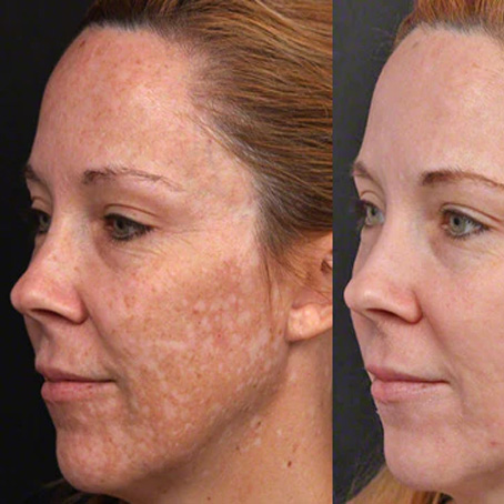 Dermasense Aesthetic Skin Clinic